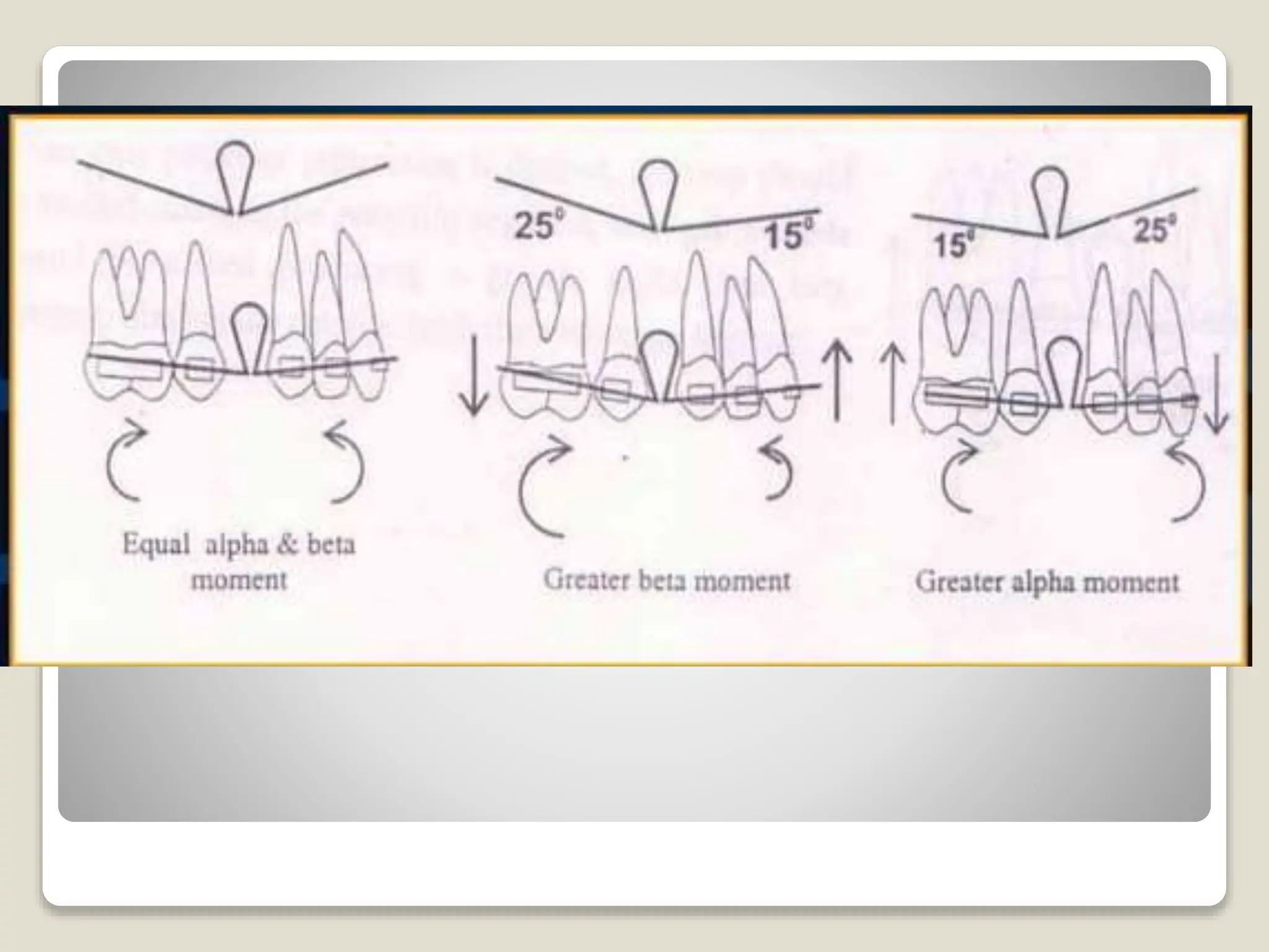FRICTIONLESS MECHANICS in orthodontics tooth movement.pptx