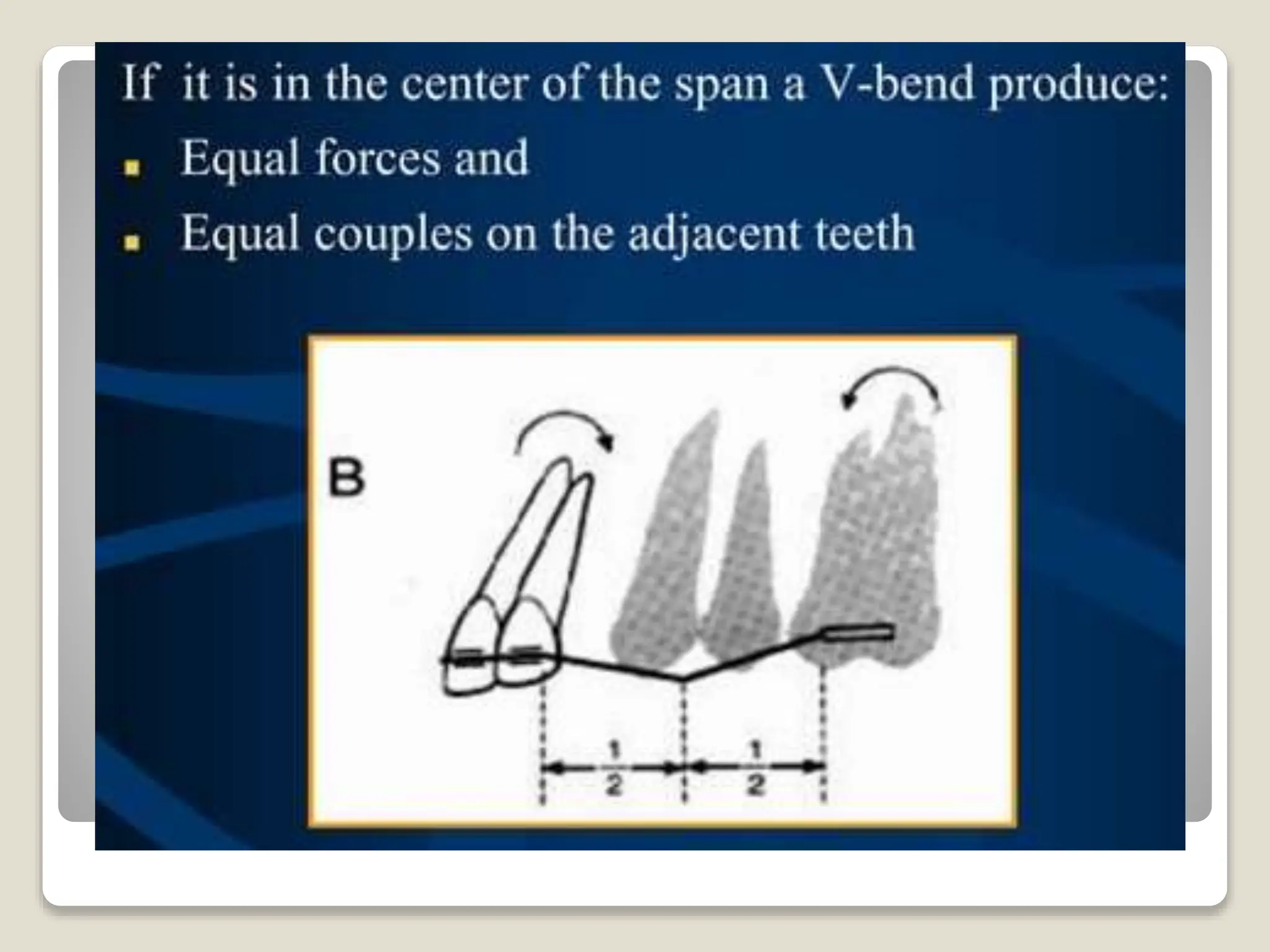 FRICTIONLESS MECHANICS in orthodontics tooth movement.pptx