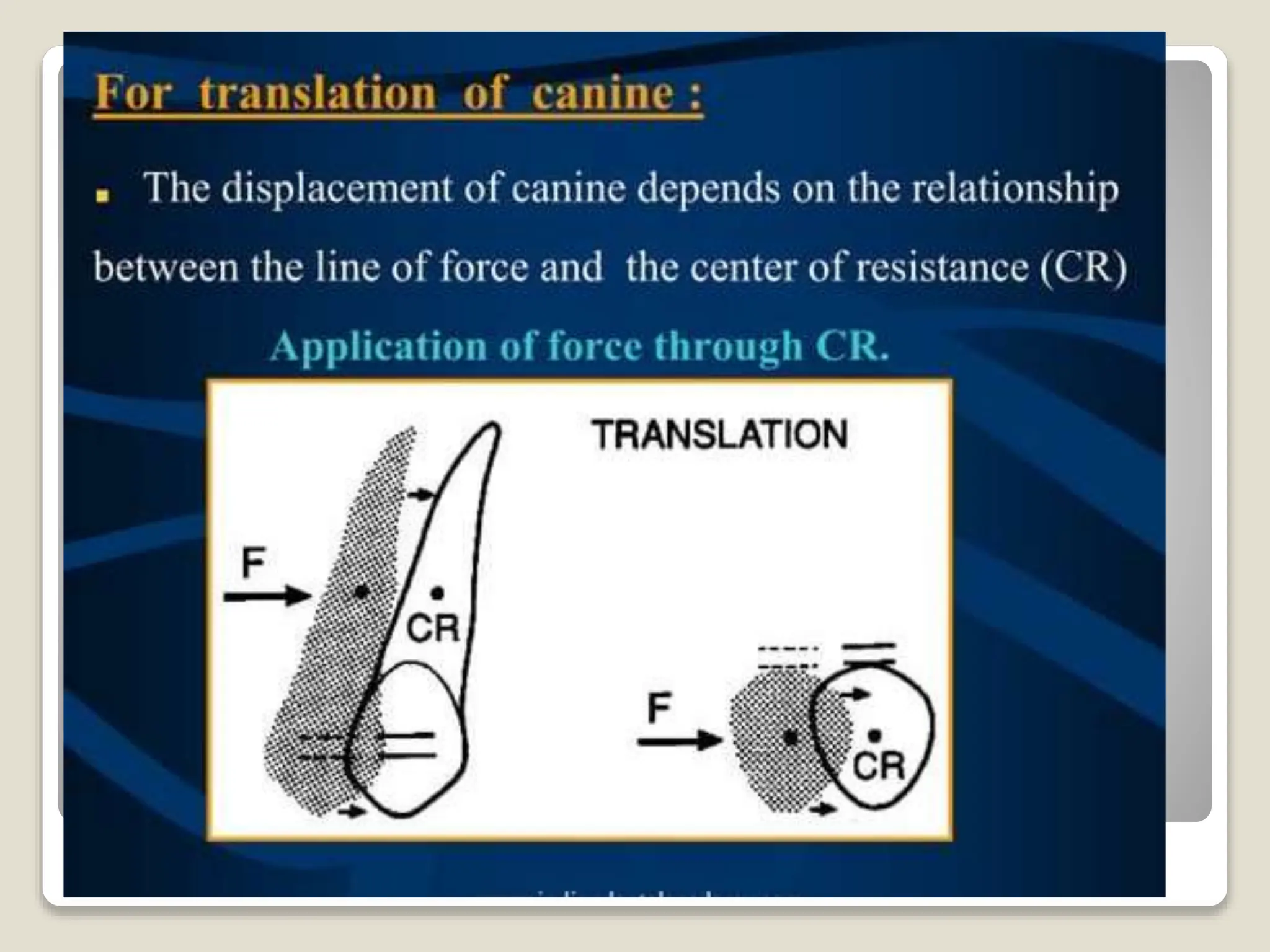 FRICTIONLESS MECHANICS in orthodontics tooth movement.pptx