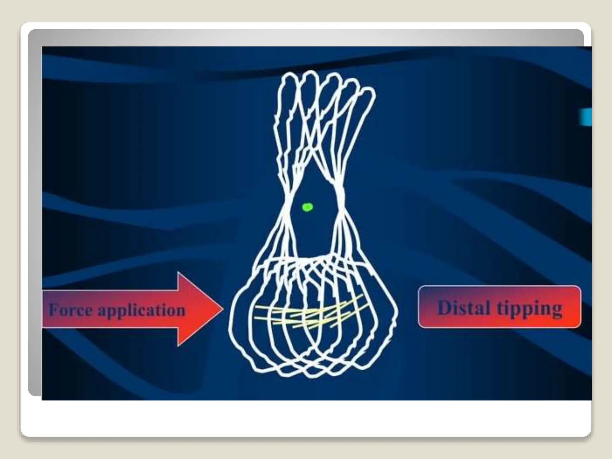 FRICTIONLESS MECHANICS in orthodontics tooth movement.pptx