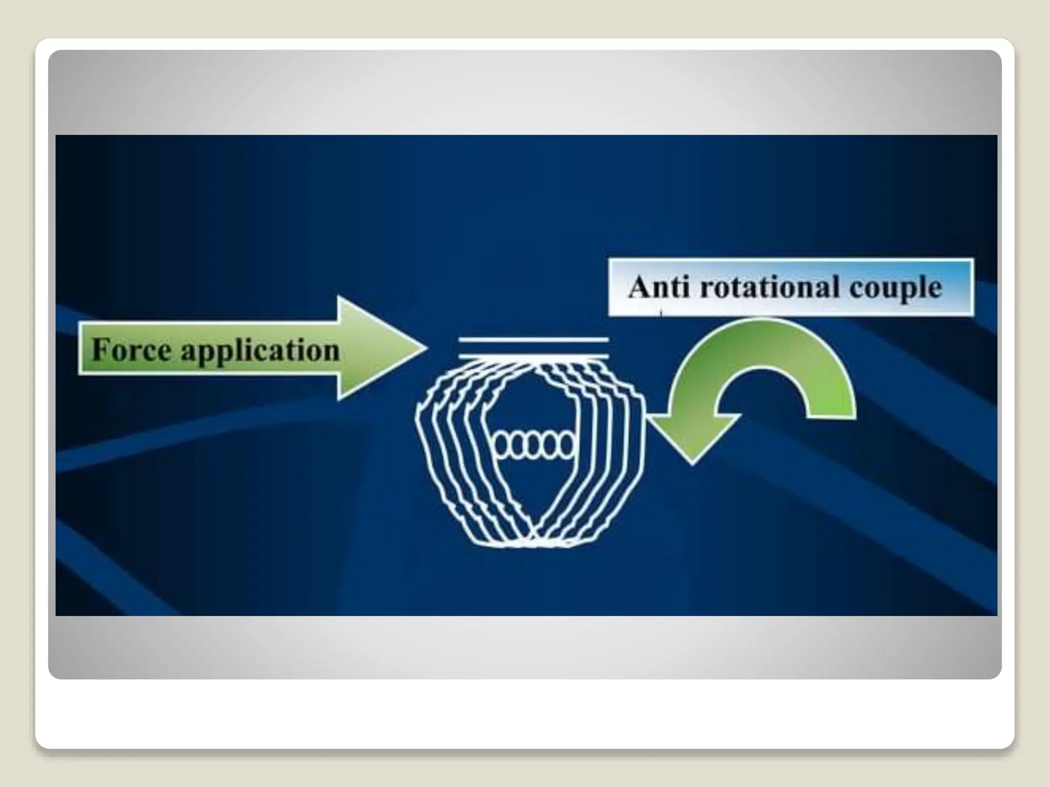 FRICTIONLESS MECHANICS in orthodontics tooth movement.pptx