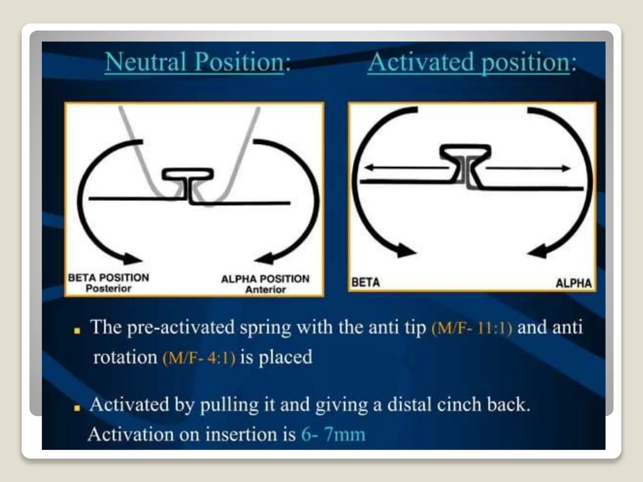 FRICTIONLESS MECHANICS in orthodontics tooth movement.pptx