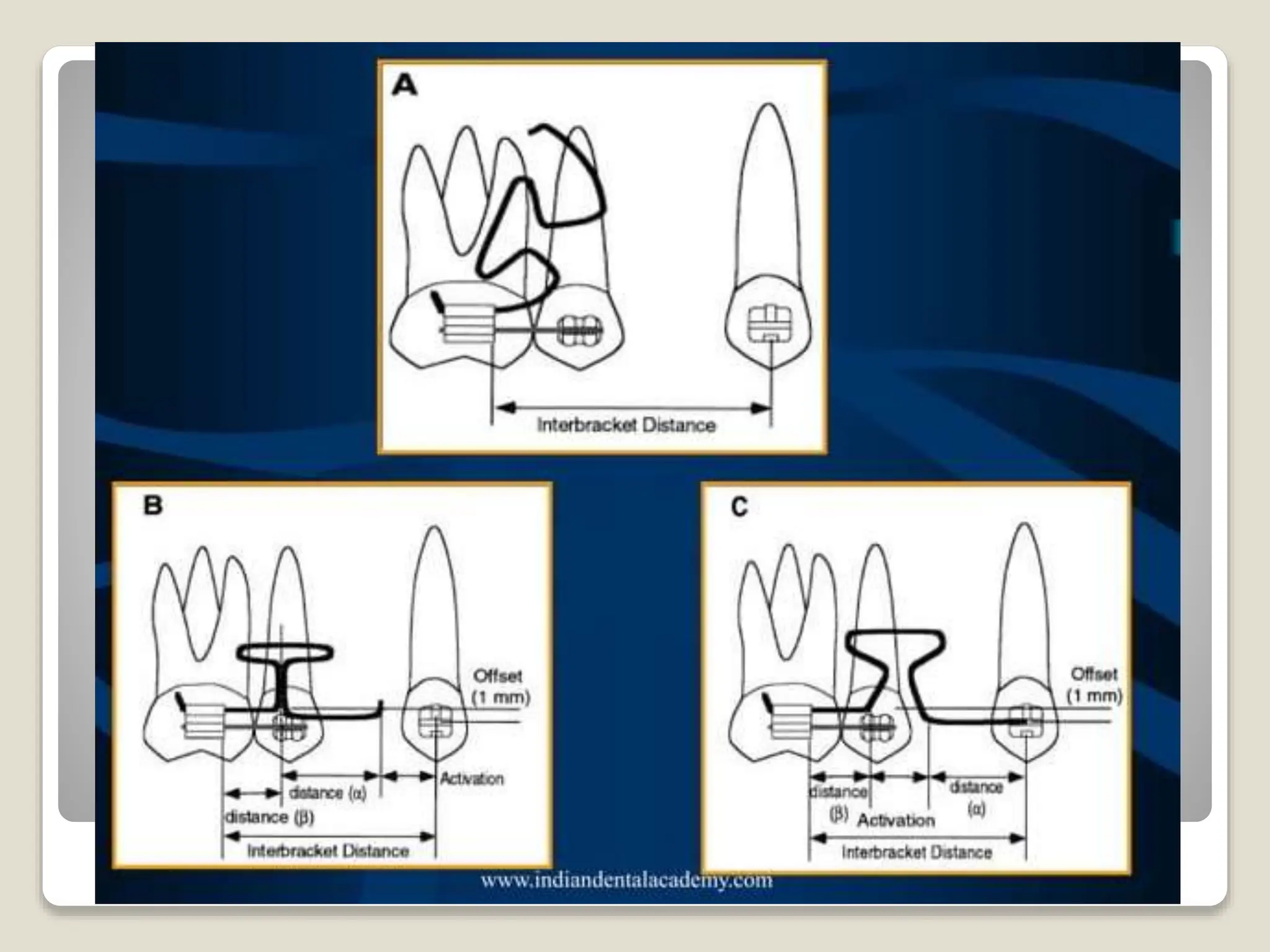 FRICTIONLESS MECHANICS in orthodontics tooth movement.pptx
