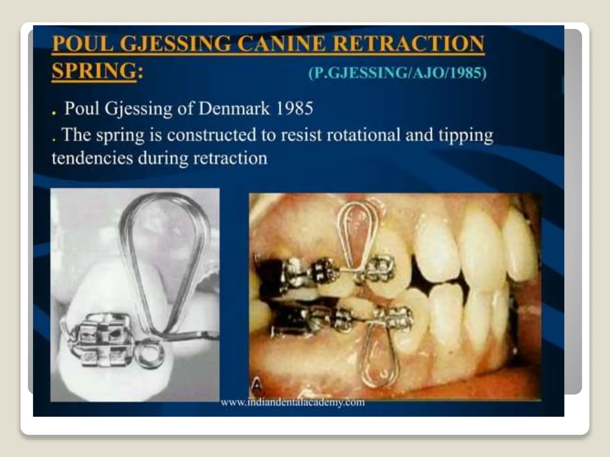 FRICTIONLESS MECHANICS in orthodontics tooth movement.pptx