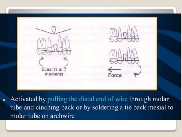 FRICTIONLESS MECHANICS in orthodontics tooth movement.pptx