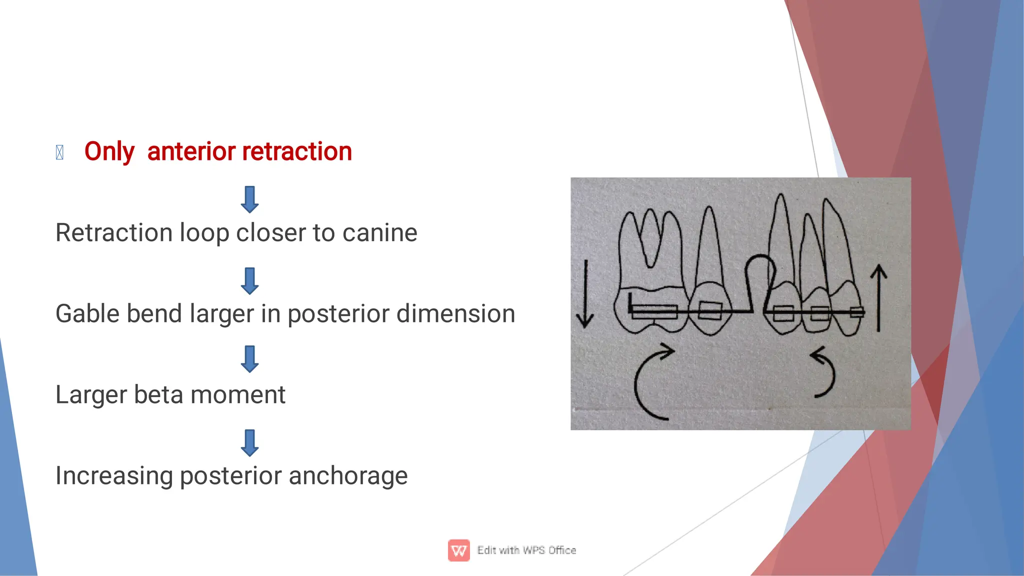 FRICTIONLESS MECHANICS in orthodontics.pdf