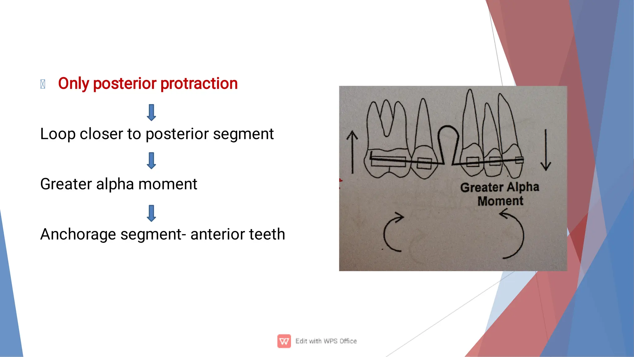 FRICTIONLESS MECHANICS in orthodontics.pdf