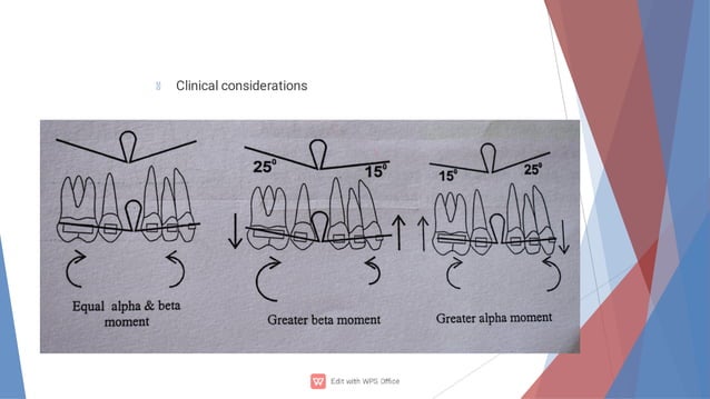 FRICTIONLESS MECHANICS in orthodontics.pdf