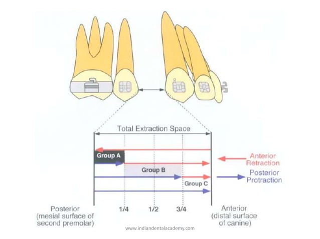 Friction mechanics /certified fixed orthodontic courses by Indian ...