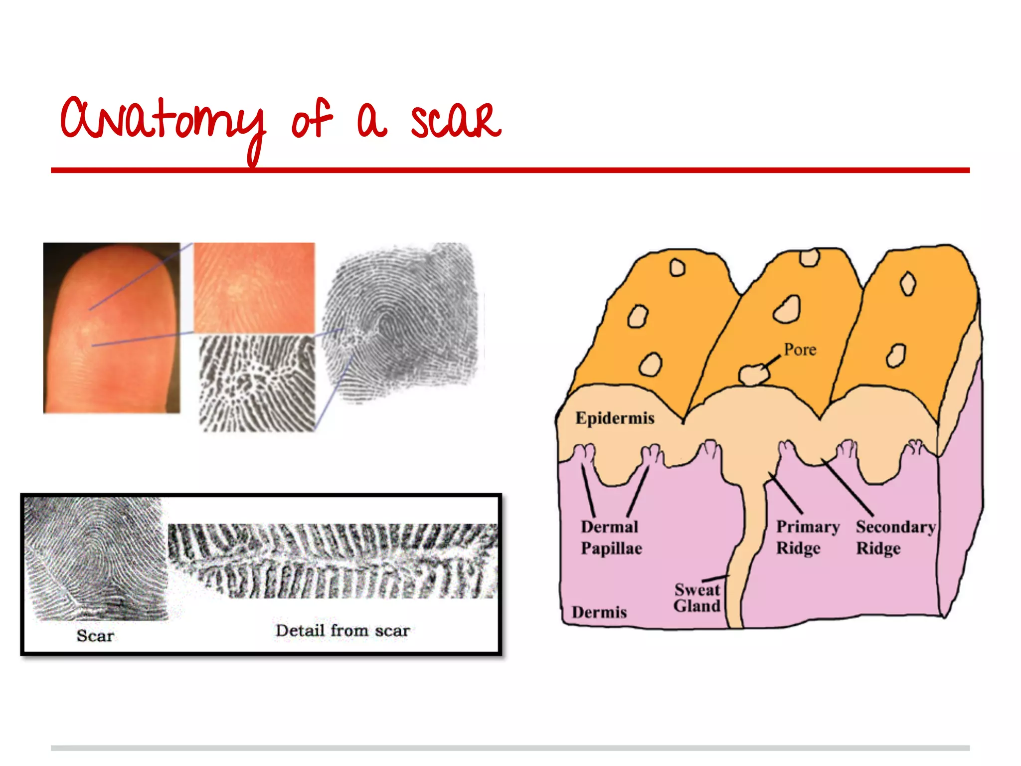 Friction ridge analysis | PDF