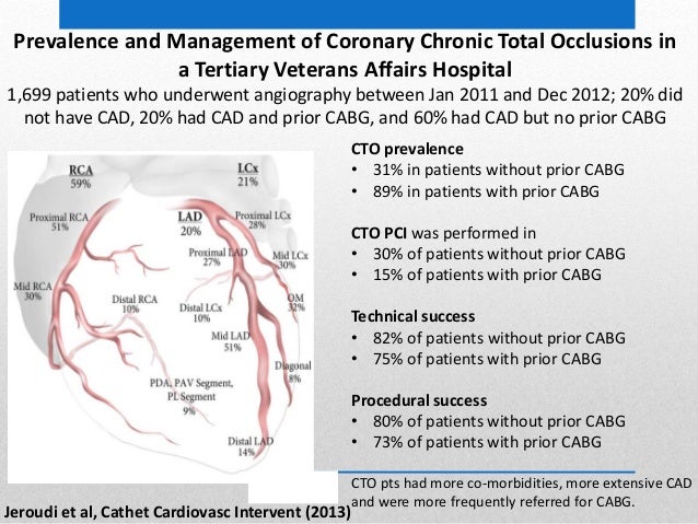 Friday 1145 Di mario - how to set up a cto program in a cath lab