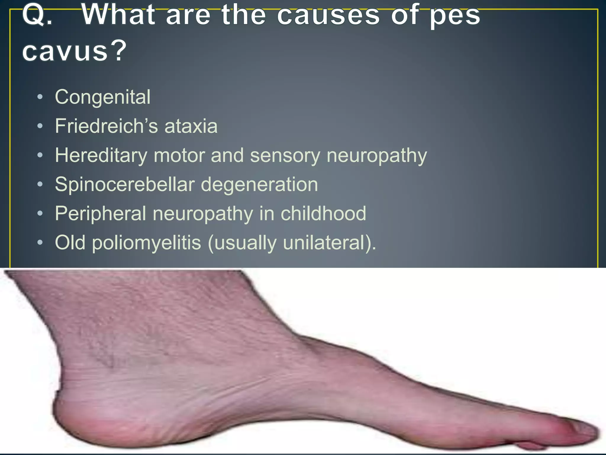 Friedreich’s ataxia.pptx