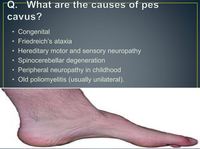 Friedreich’s ataxia.pptx