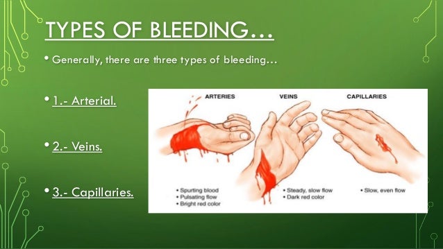Frist aid of bleeding, gks