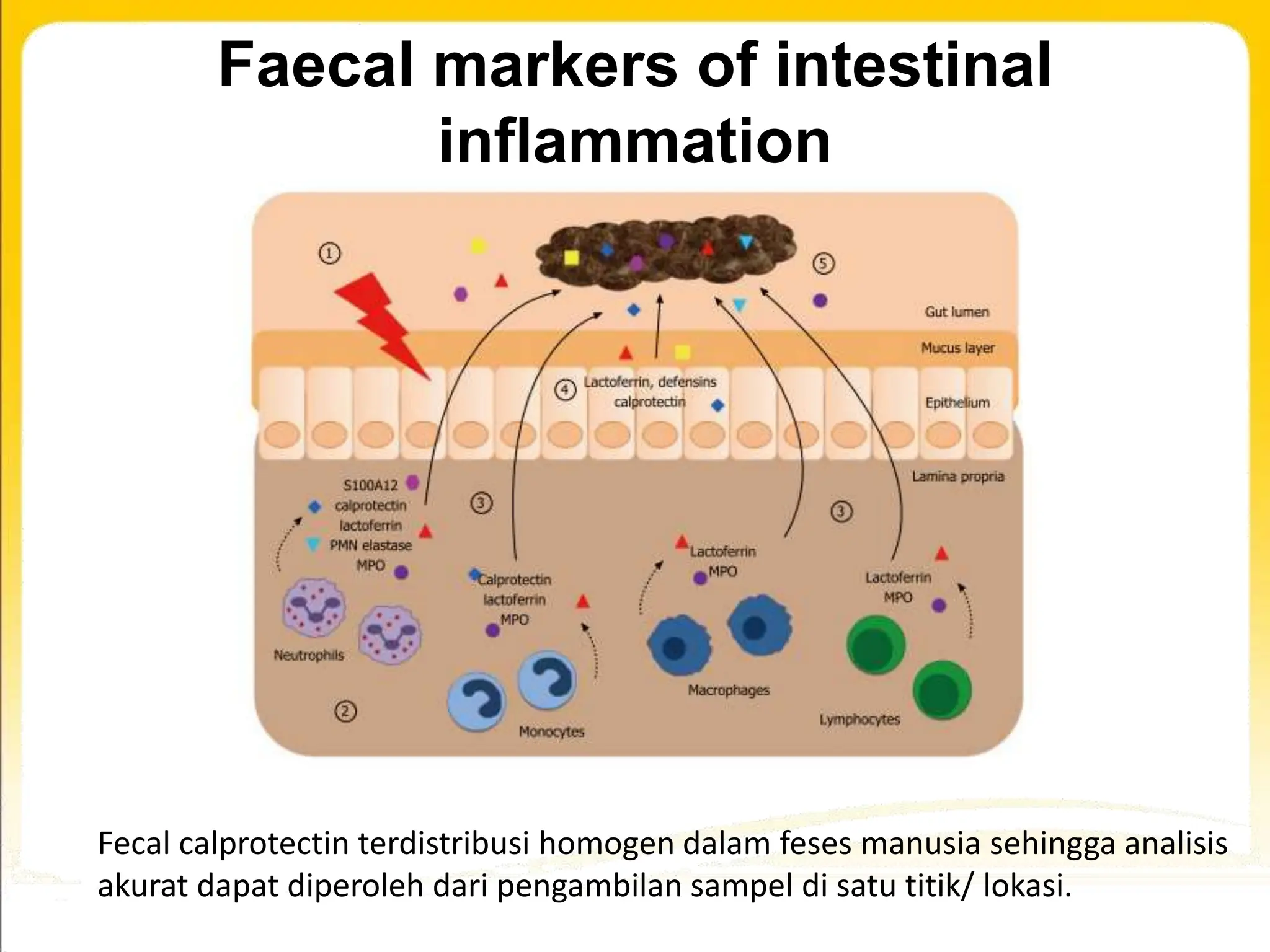 FRISTY GASTRO -Fecal-Calprotectin copy.ppt