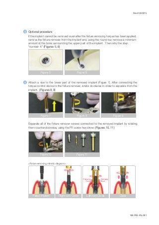 NeoBiotech - FR kit user guide | PDF