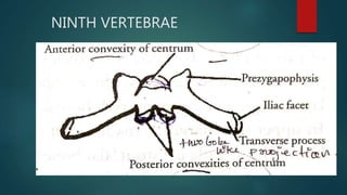Typical Vertebra Of Frog