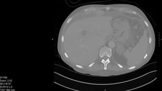 CT scan introduction for surgical residents | PPTX