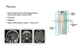 CT scan introduction for surgical residents | PPTX | Medical Tests ...