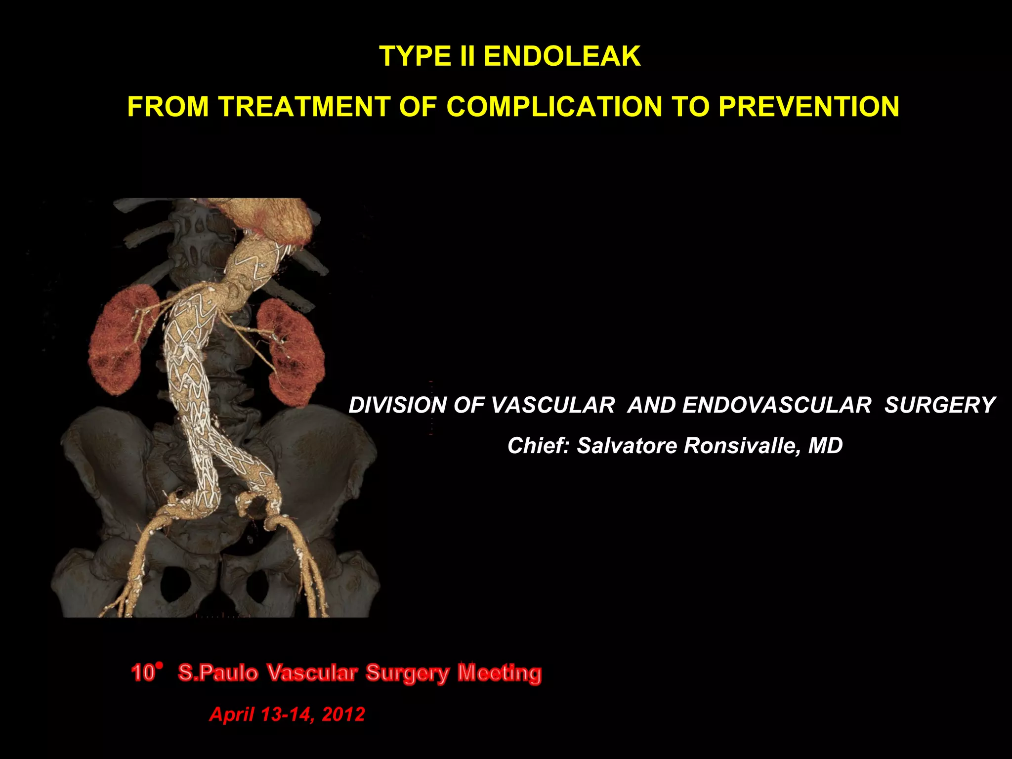 TYPE II ENDOLEAK: FROM TREATMENT OF COMPLICATION TO PREVENTION | PPT