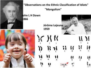 From down syndrome screening to nipt | PPT