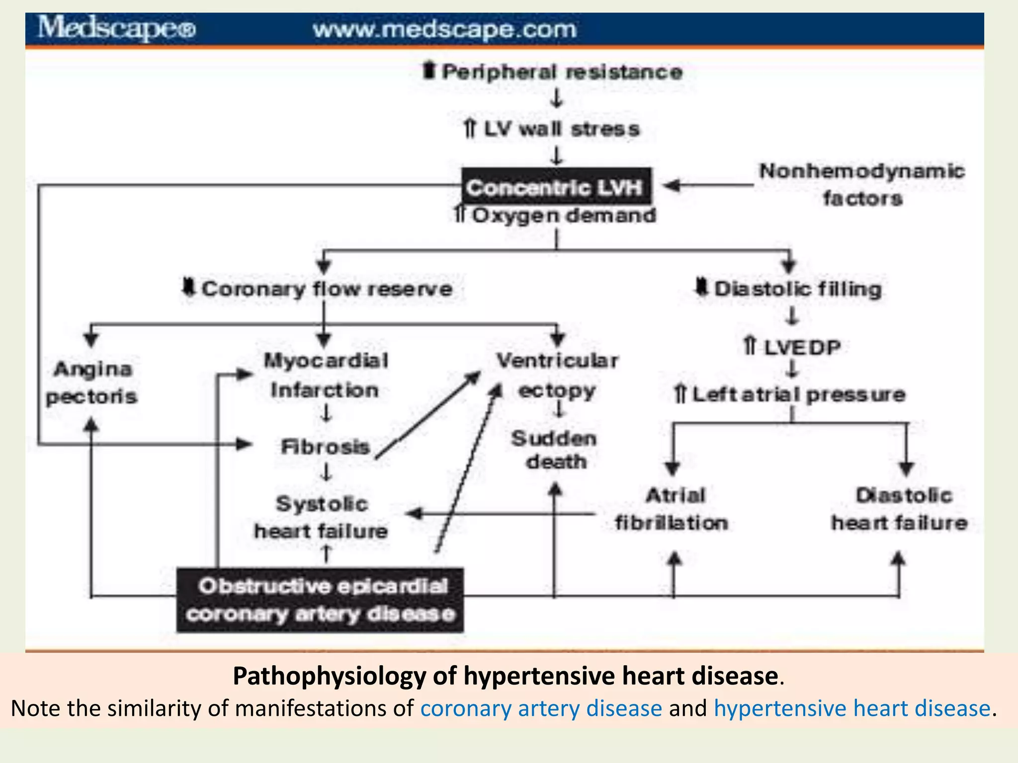 The Progression of Hypertensive Heart Disease.From hypertension to ...