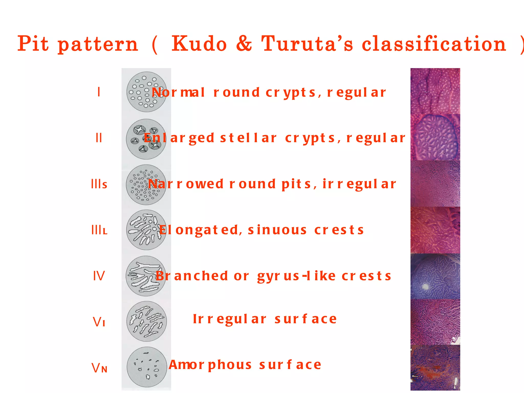 Japan GIT endoscopy training course.March 2011. | PPT