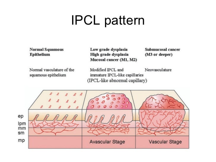 Japan GIT endoscopy training course.March 2011.