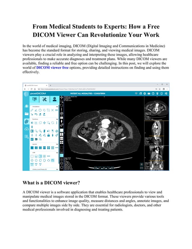 From Medical Students to Experts How a Free DICOM Viewer Can Revolutionize Your Work.pdf