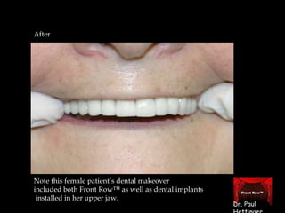 Front row-smile-gallery | PPTX