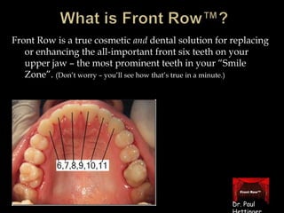 Front row-smile-gallery | PPTX