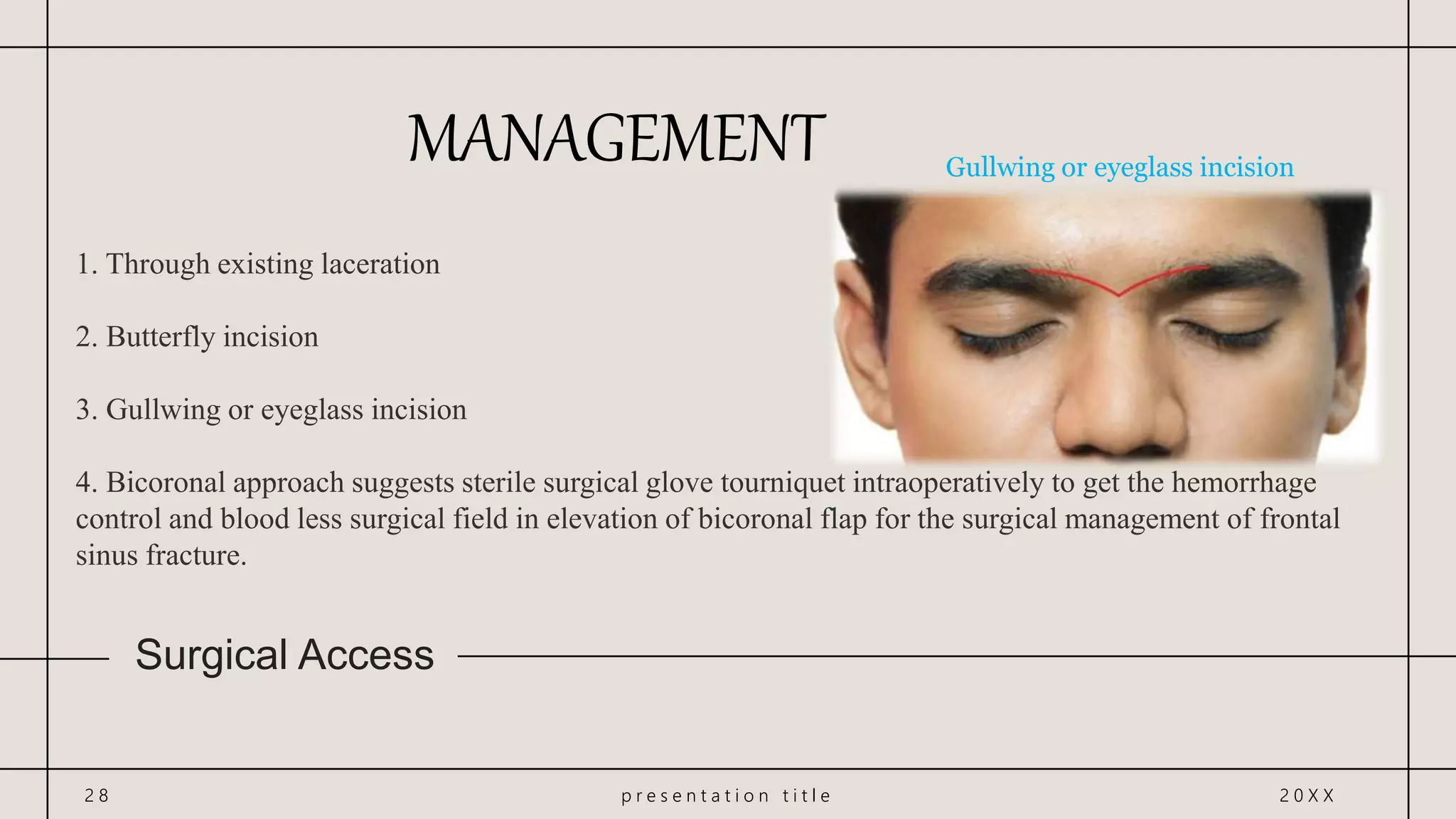 FRONTAL BONE FRACTURE AND ITS MANAGEMENT.pptx