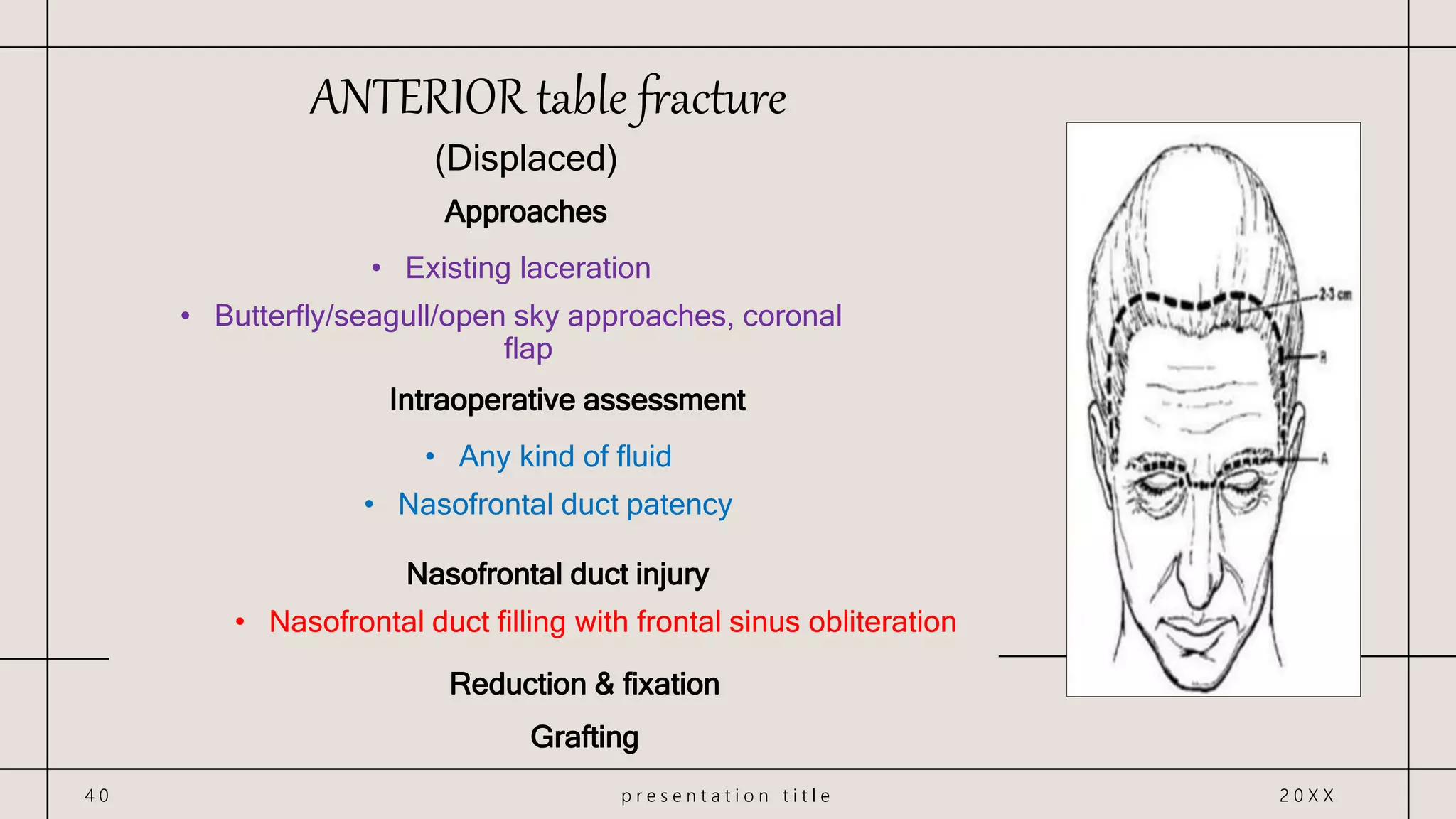 FRONTAL BONE FRACTURE AND ITS MANAGEMENT.pptx