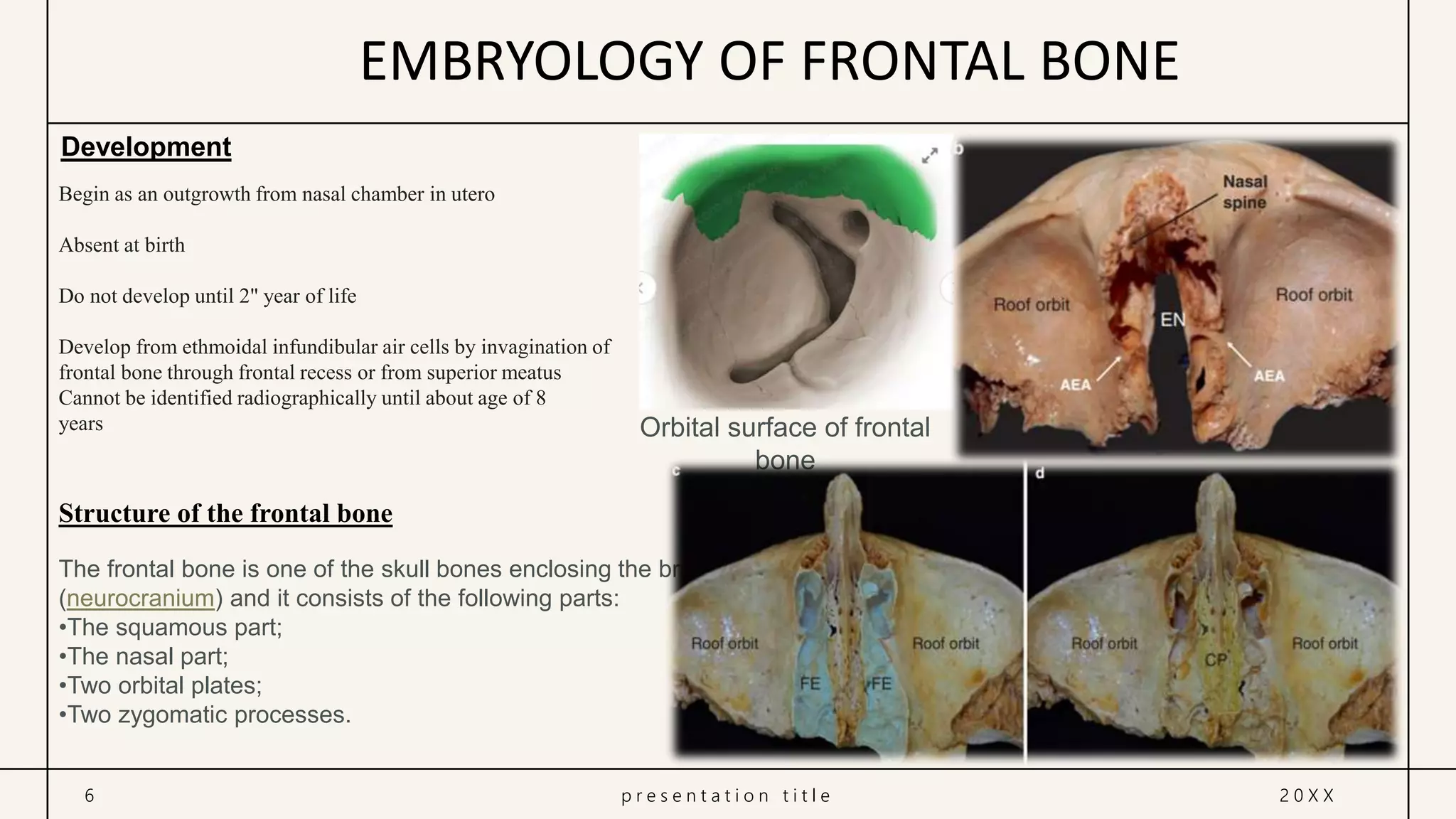 FRONTAL BONE FRACTURE AND ITS MANAGEMENT.pptx