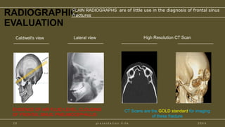 FRONTAL BONE FRACTURE AND ITS MANAGEMENT.pptx