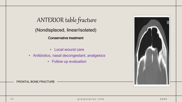 FRONTAL BONE FRACTURE AND ITS MANAGEMENT.pptx | Death, Injury, or ...