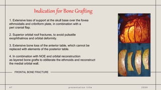 FRONTAL BONE FRACTURE AND ITS MANAGEMENT.pptx