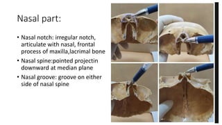 Frontal bone ppt (1) | PPTX