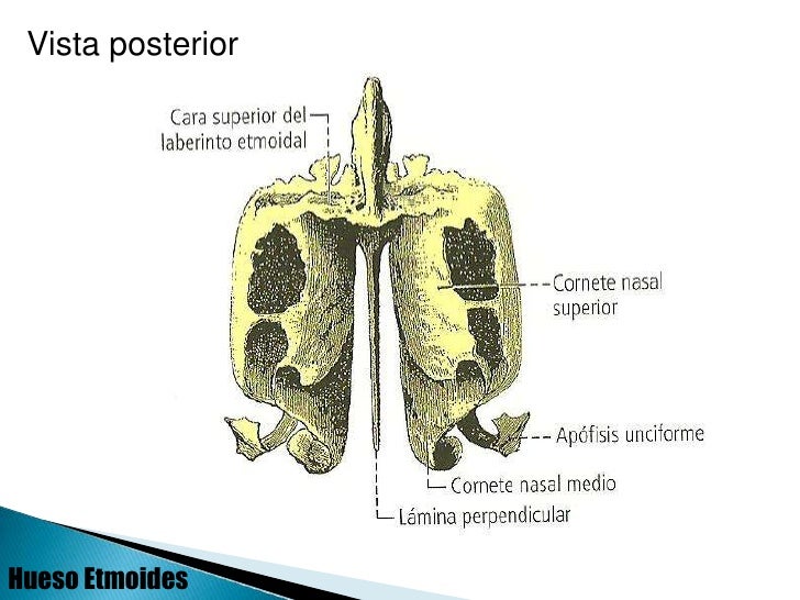 Vista Anterior Del Etmoides - todayelectronic