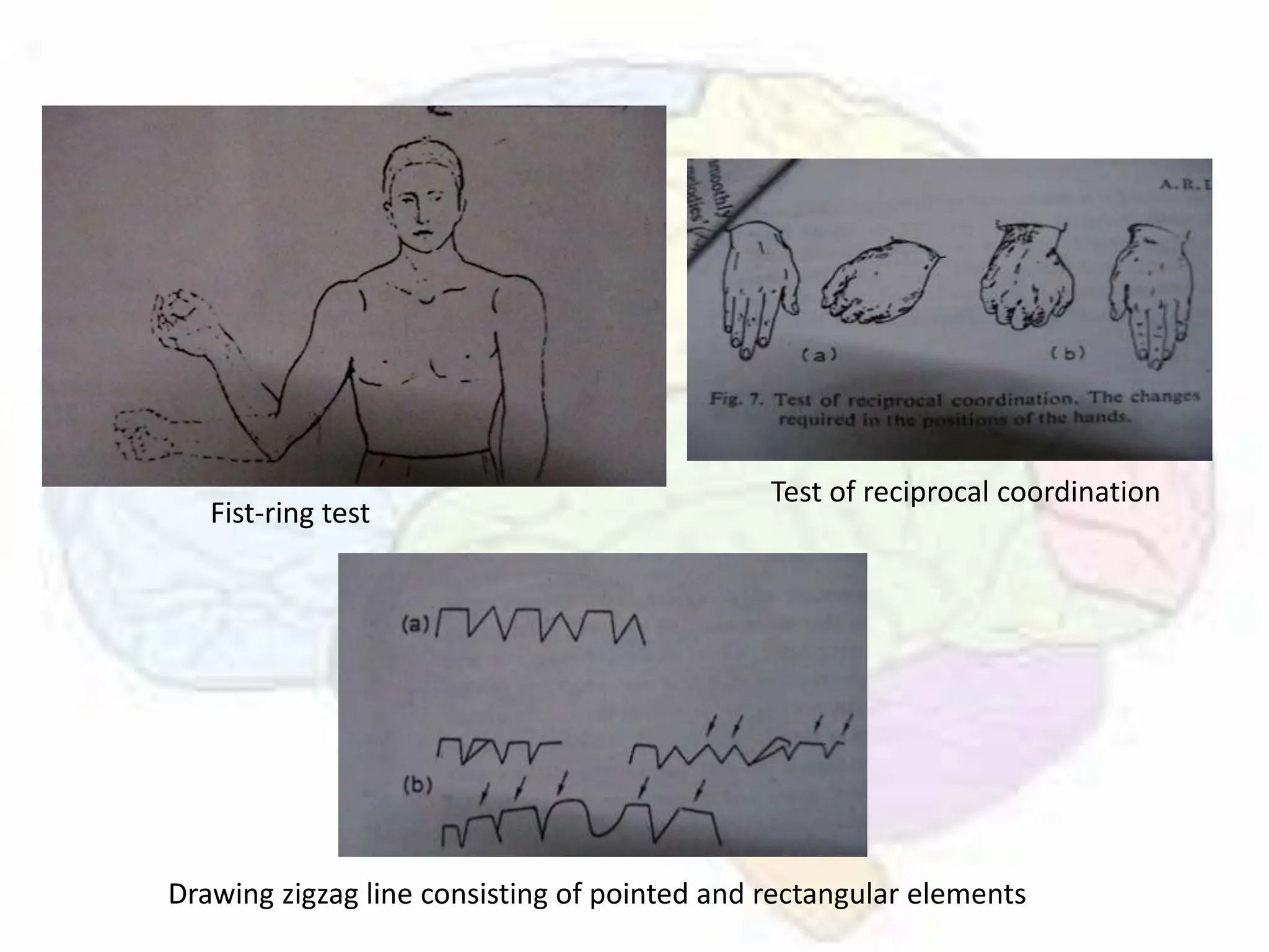 Frontal Lobar Function tests.pptx