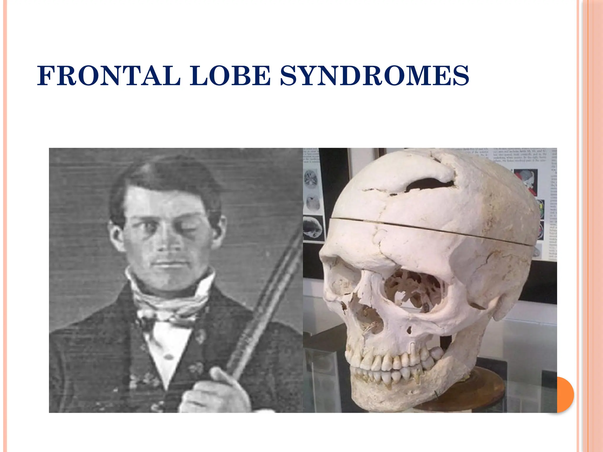 Anatomy and physiology of the FRONTAL LOBE- | PPT