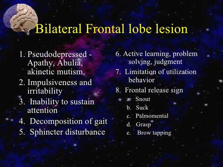 Frontal lobe