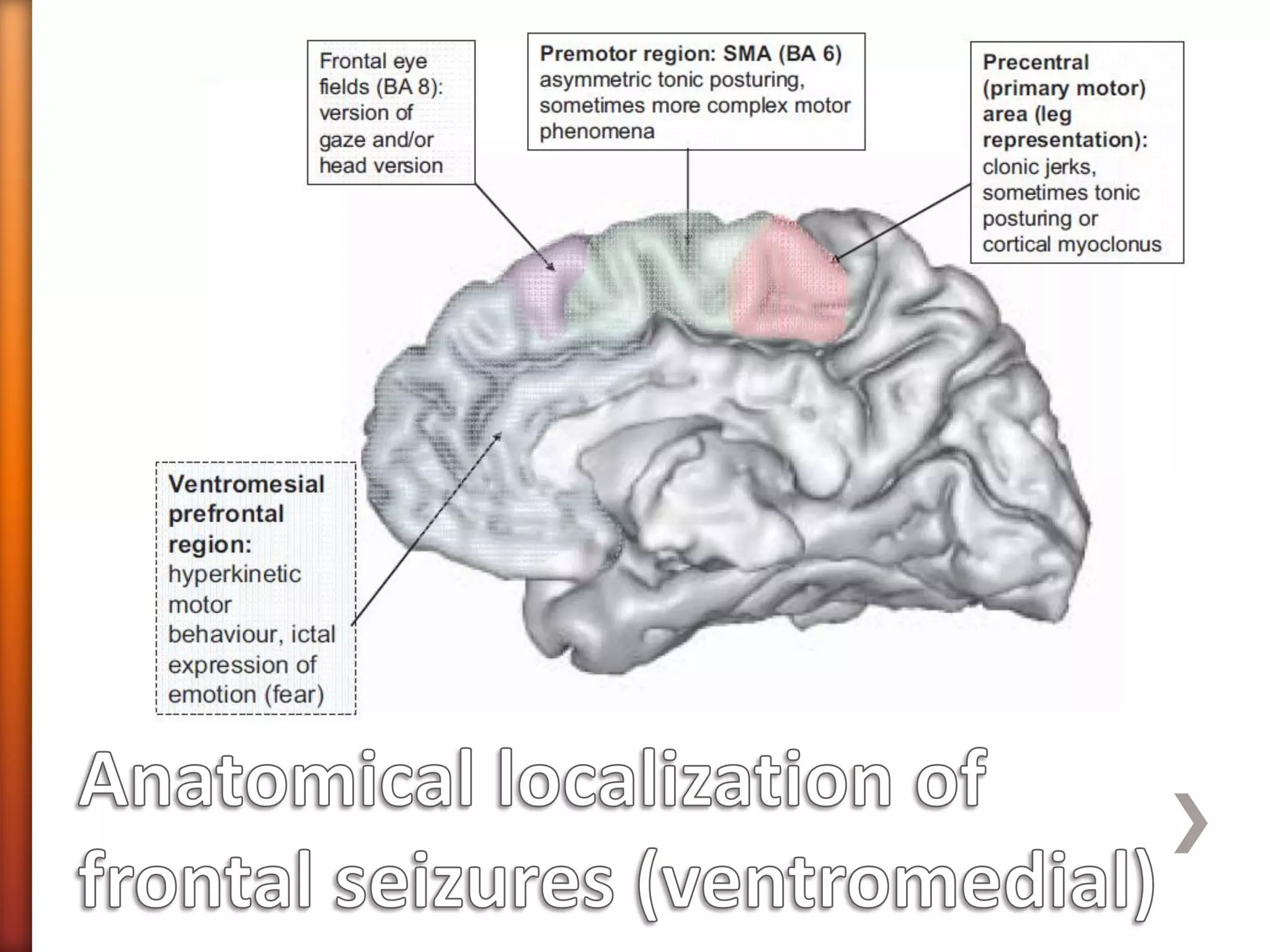 Frontal lobe epilepsy | PDF