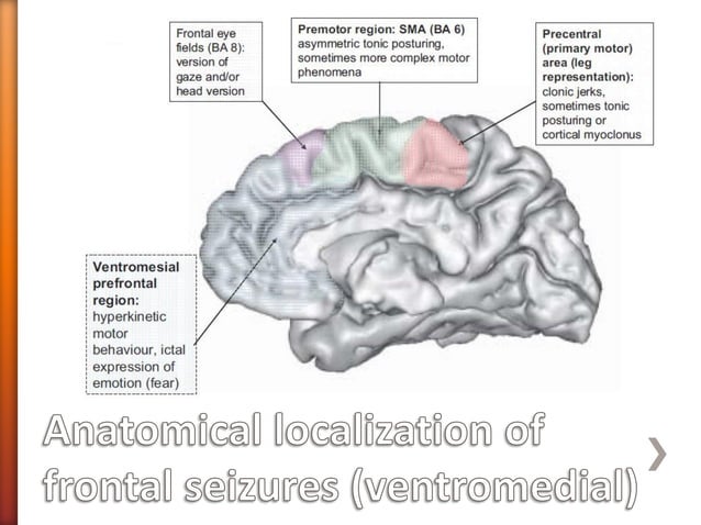 Frontal lobe epilepsy | PDF