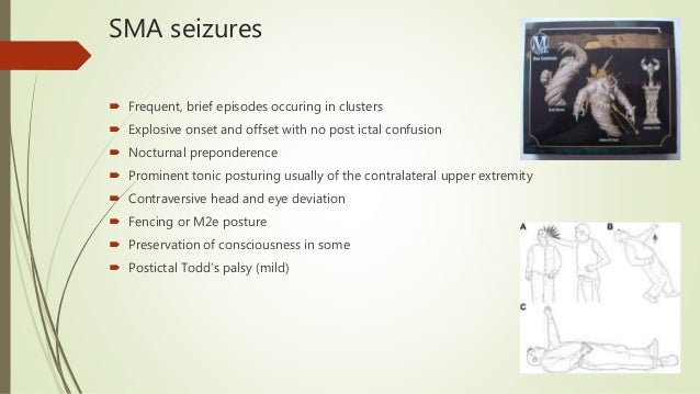 Frontal lobe epilepsy