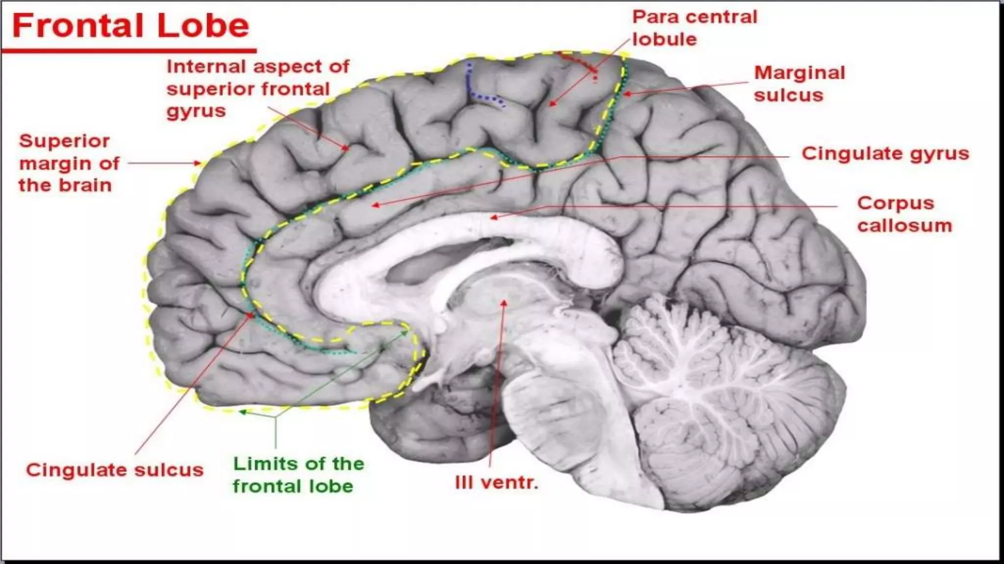 Frontal lobe syndromes | PPTX | Brain and Nervous System Disorders ...