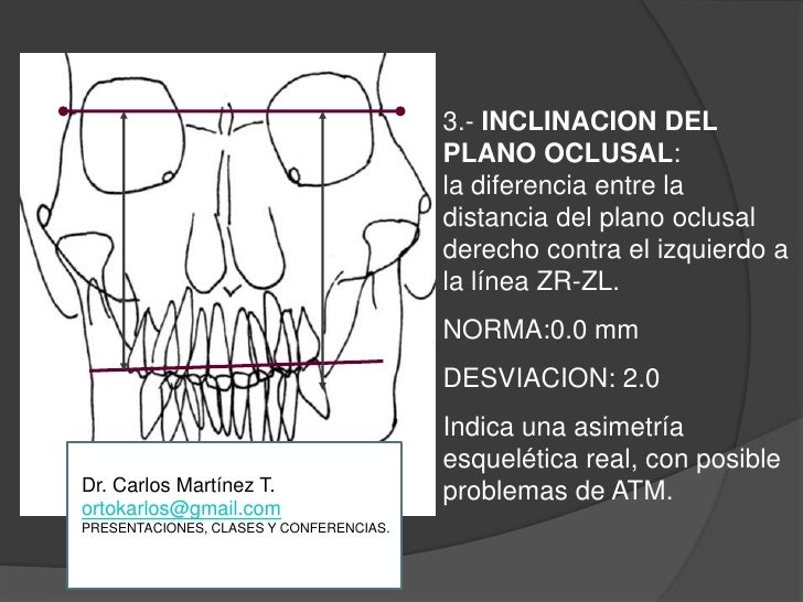 Ricketts Frontal Cephalometric