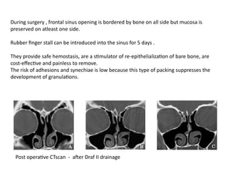 Approach to frontal sinus. Presentation. | PPTX