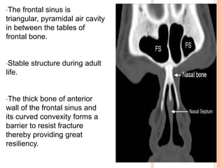 Frontal sinus as a tool in identification | PPT