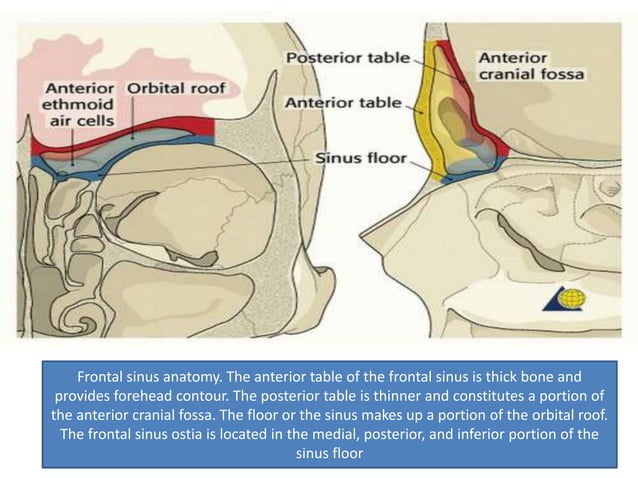 Frontal sinus fracture | PPT